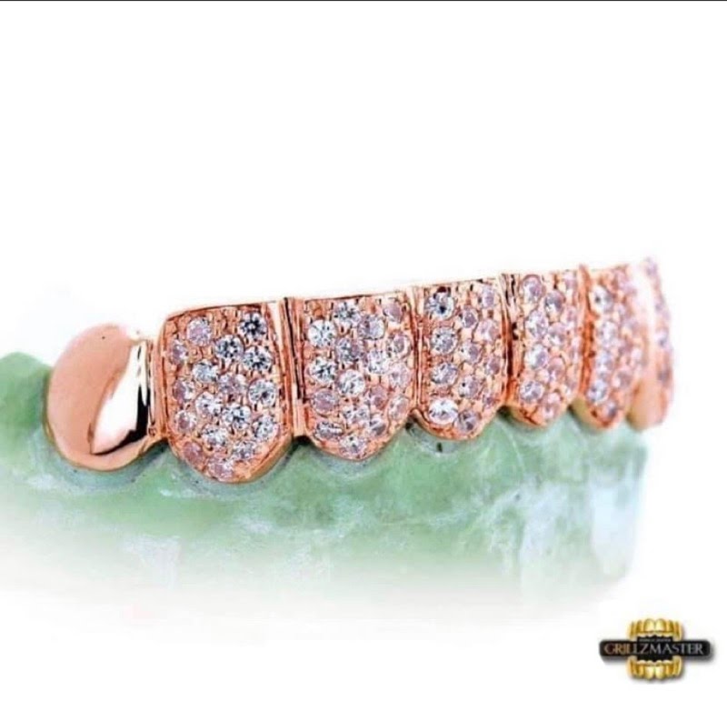 Diamond Grillz – Grillz Masters